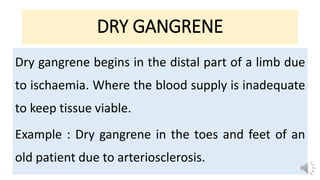 Gangrene #Types of gangrene | PPTX