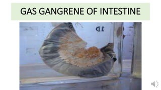 Gangrene #Types of gangrene | PPTX