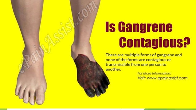 Gangrene | PPTX