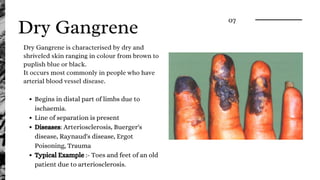 Gangrene | PPT