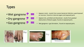 Internal Gangrene