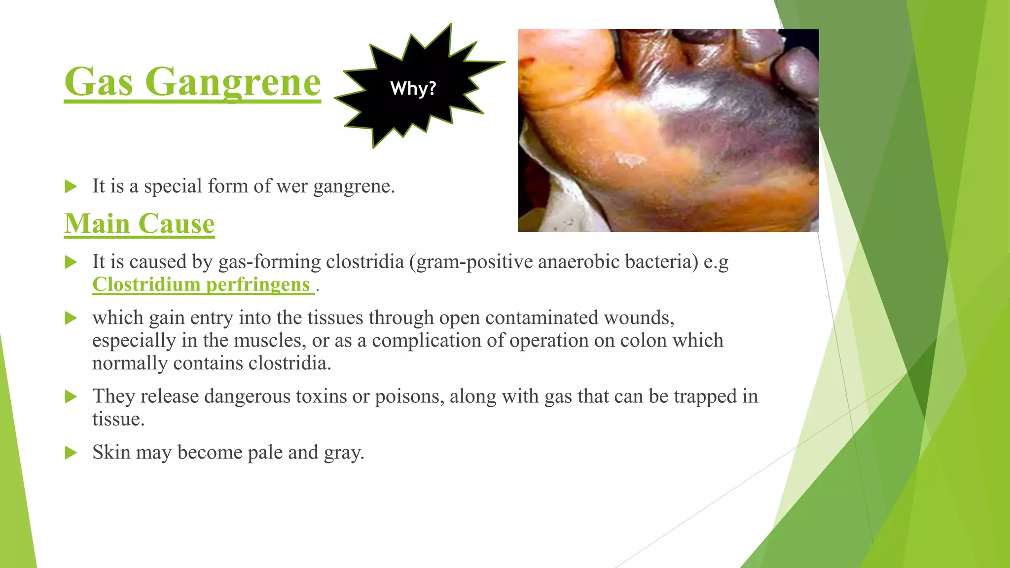 Gangrene.pptx