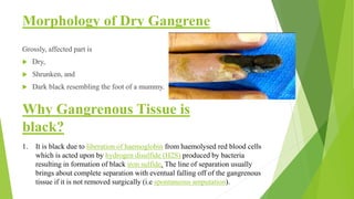 Gangrene.pptx