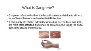 GANGRENE.ppt explaining types and causes | PPTX