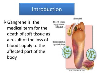 Gangrene and amputation | PPTX