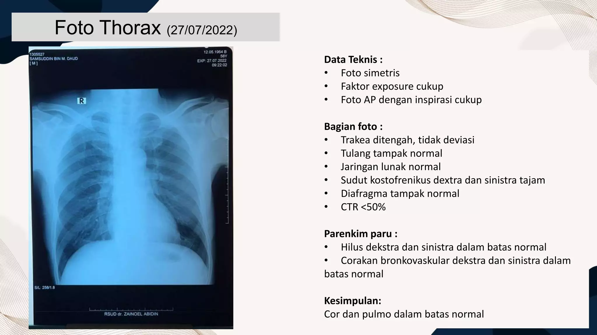 Gangrene Diabetikum.pptx