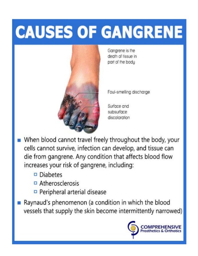 Gangrene