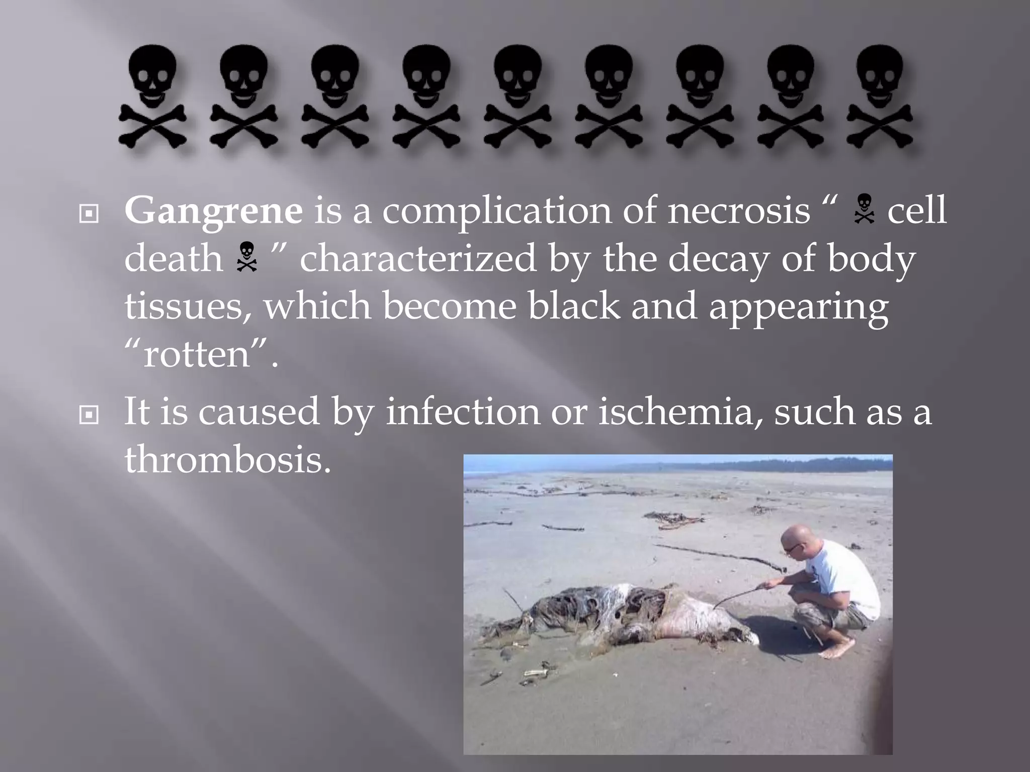 Gangrene powerpoint-1.pptx