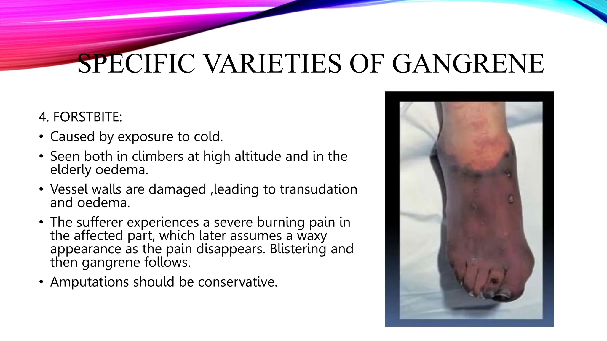 gangrenepresentation.pptx for healthcare | PPTX