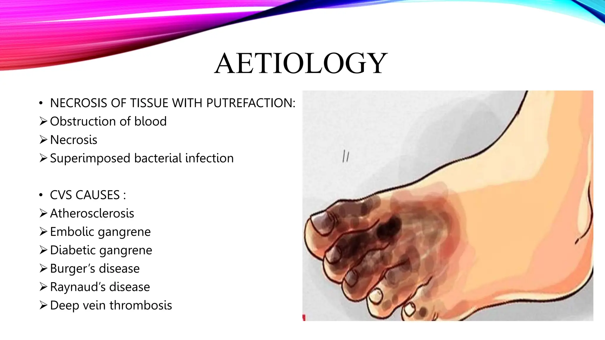 gangrenepresentation.pptx for healthcare | PPTX