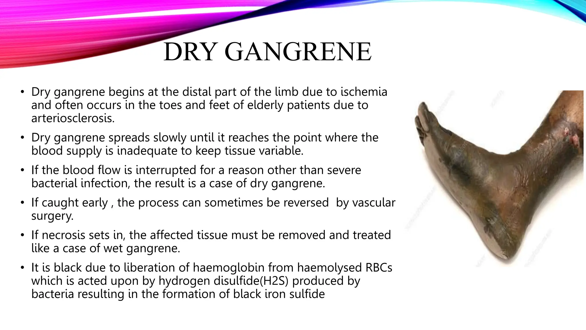 gangrenepresentation.pptx for healthcare | PPTX