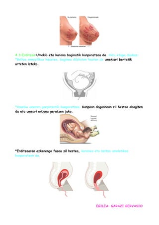 Garazi ugalketa aparatua | PDF