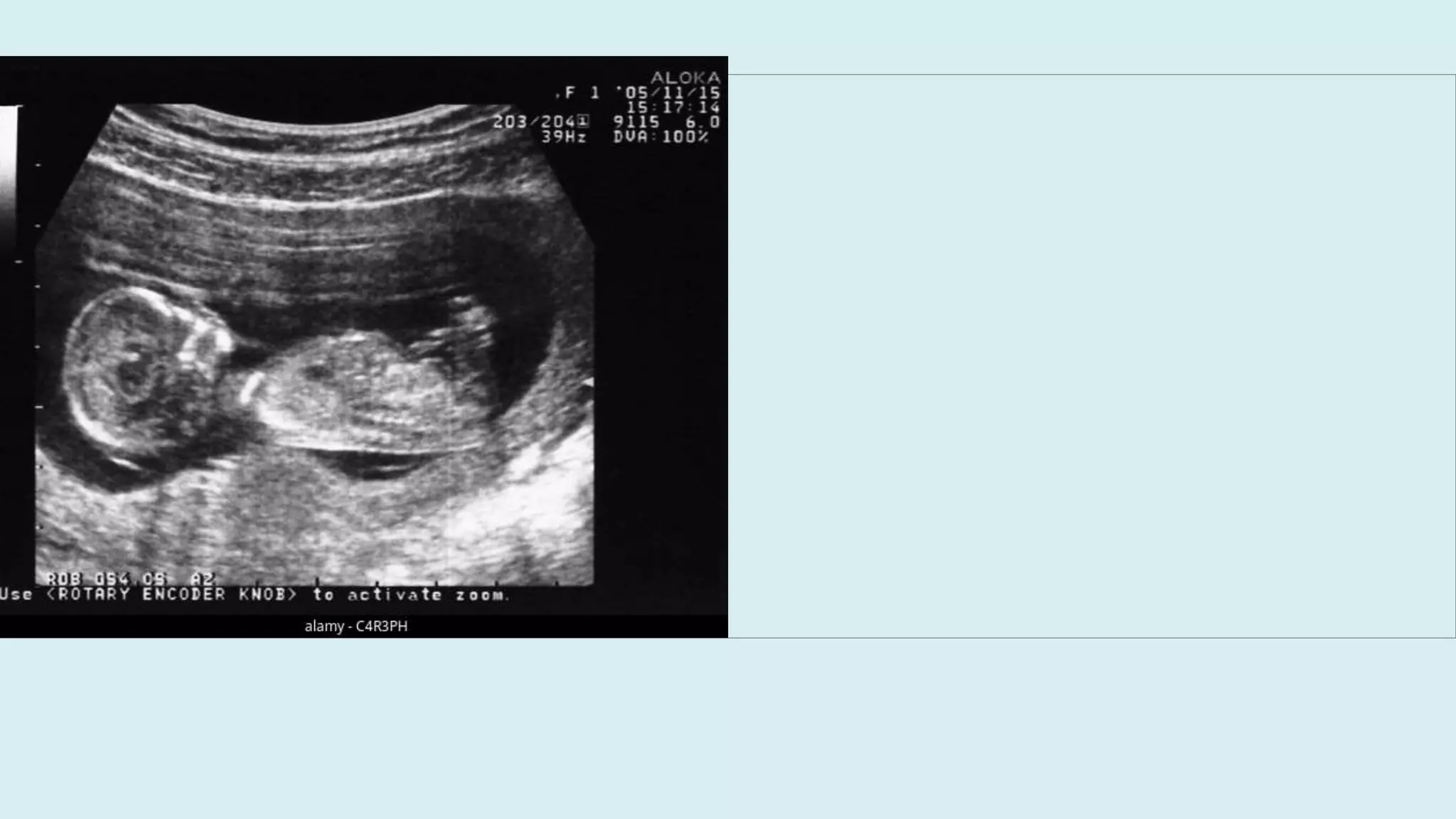 Garbha and masanumasika garbha vruddhi krama with special.pptx