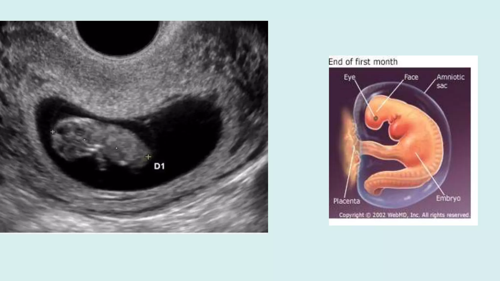 Garbha and masanumasika garbha vruddhi krama with special.pptx