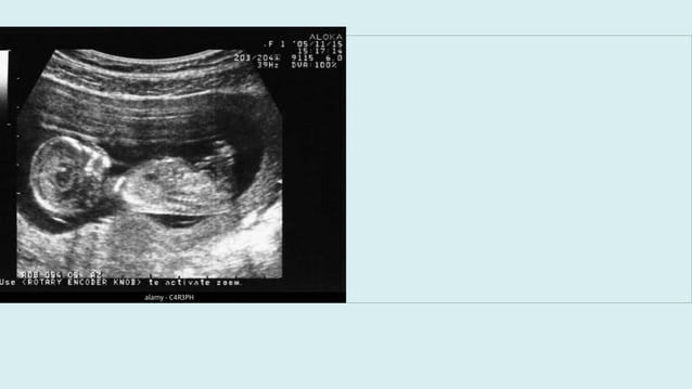 Garbha and masanumasika garbha vruddhi krama with special.pptx