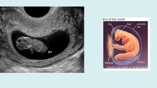 Garbha and masanumasika garbha vruddhi krama with special.pptx