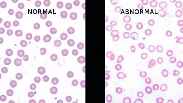 Garbhini vyapad new | PDF | Pregnancy | Reproductive Health