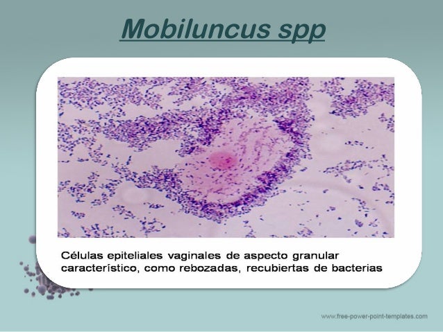 Gardnerella, mubilluncus y lactobacillus