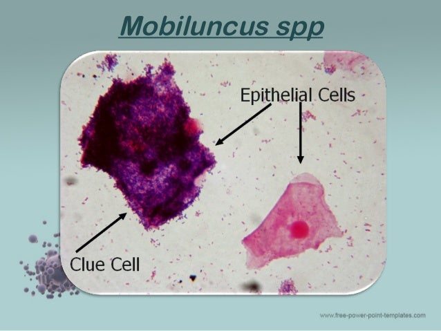 Gardnerella, mubilluncus y lactobacillus