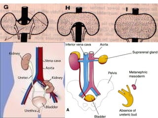 Development of Kidney | PPT