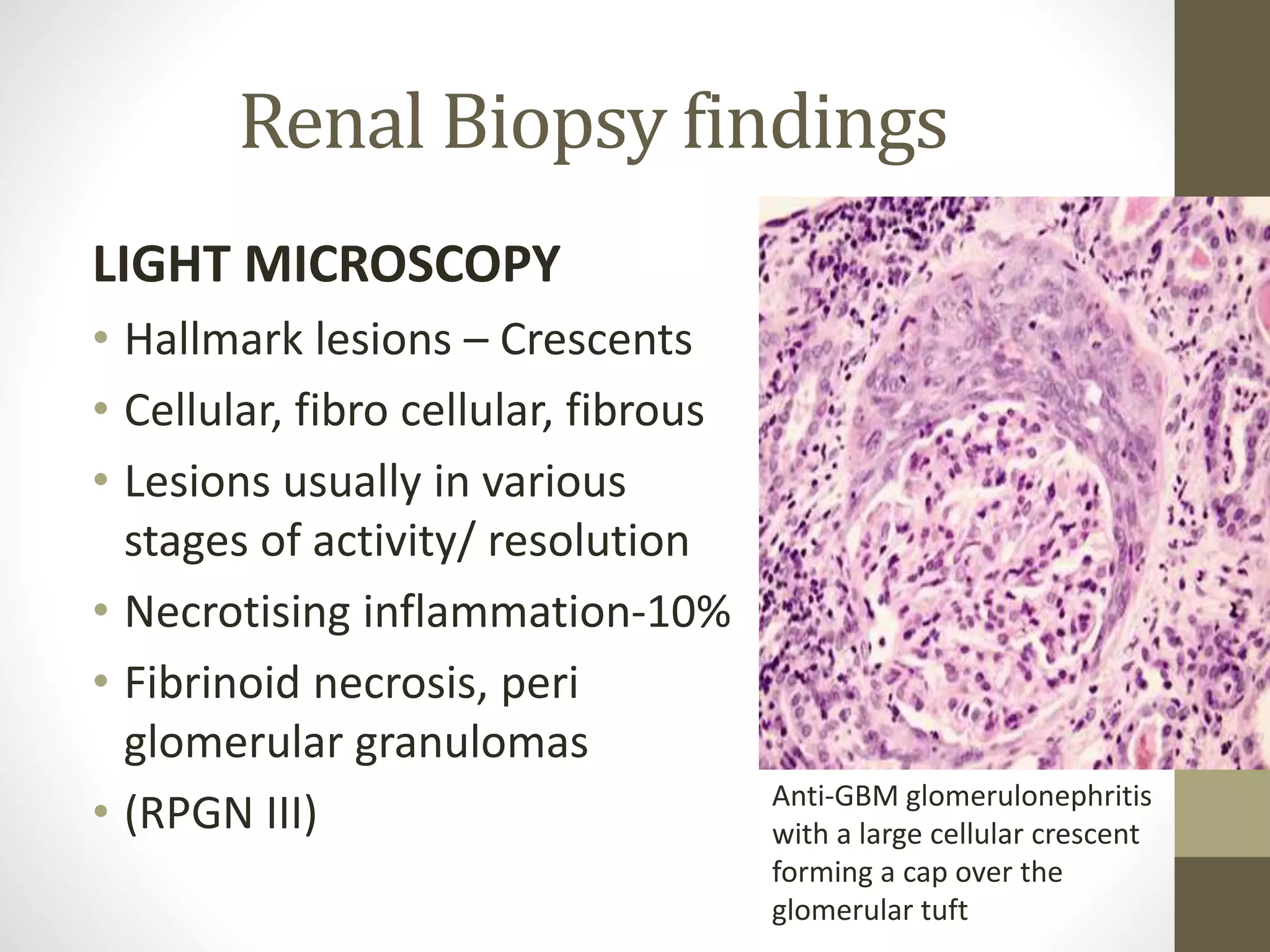 Approach to Rapidly Progressive Glomerulonephritis RPGN | PPTX