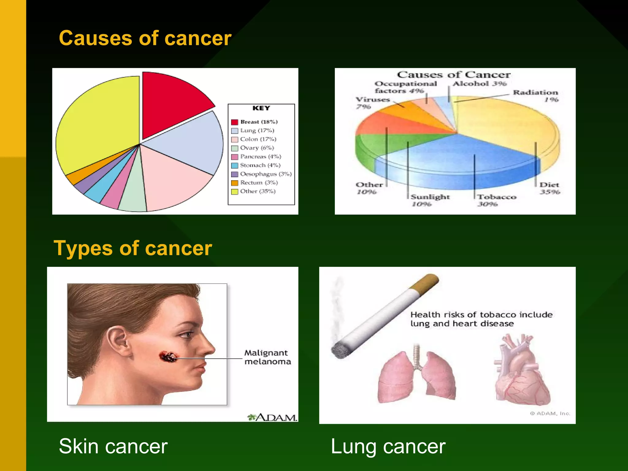 CANCER | PPT