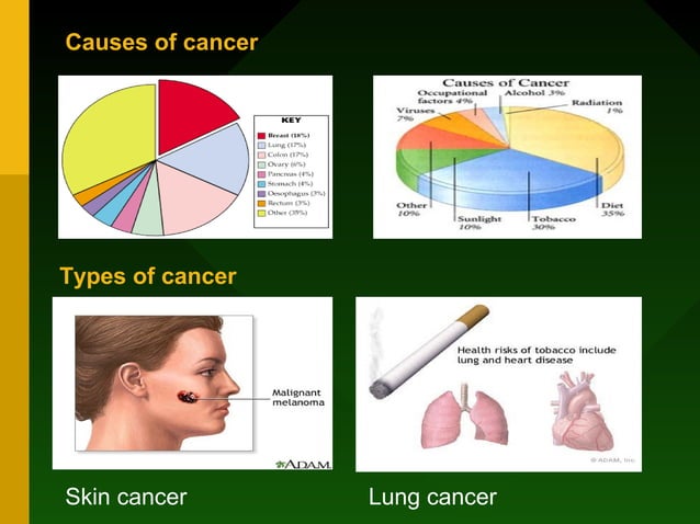 CANCER | PPT | Cancer | Diseases and Conditions