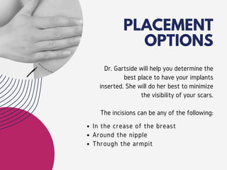 Breast Implants: Your Guide | PPT