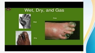 Epidemiology ,control and management of gas gangrene | PPTX