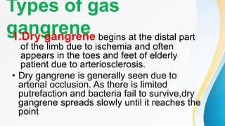 Epidemiology ,control and management of gas gangrene | PPTX