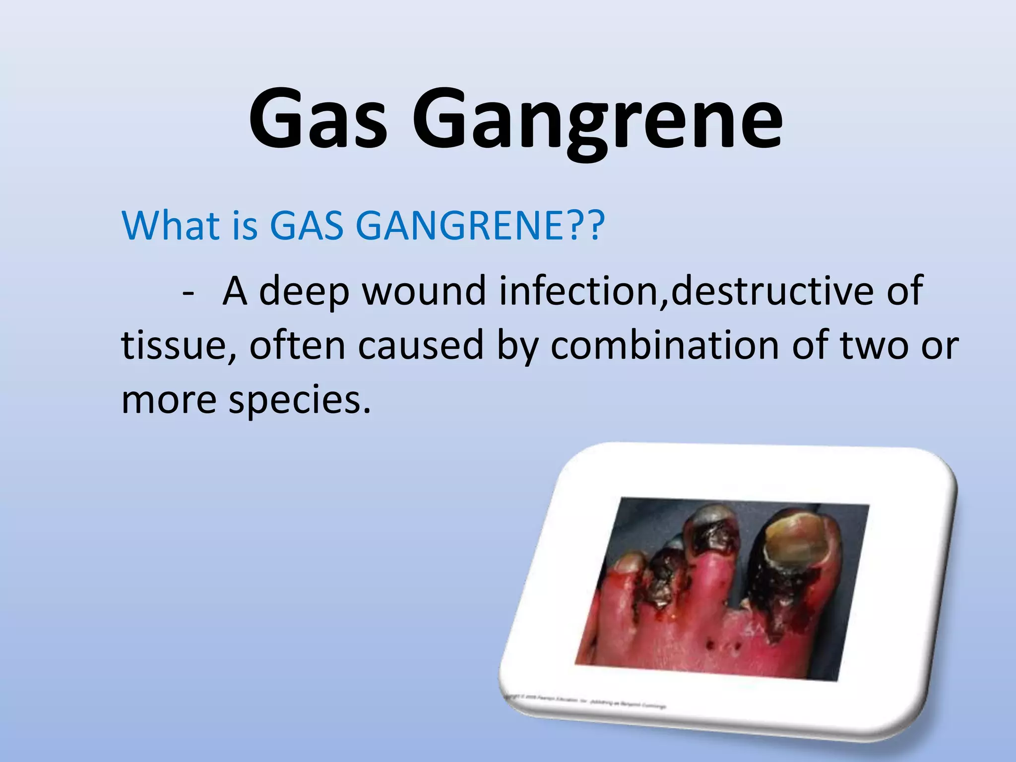 Gas gangrene | PPTX