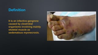 Gas gangrene | PPTX