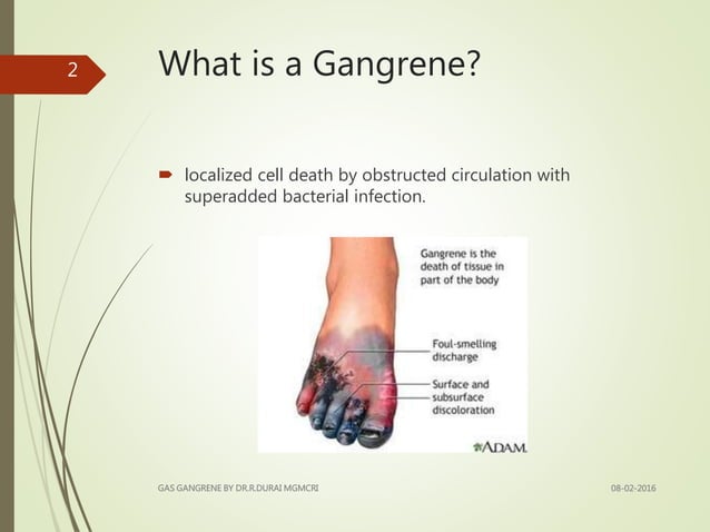 Gas gangrene 8 - 2- 16 | PPTX