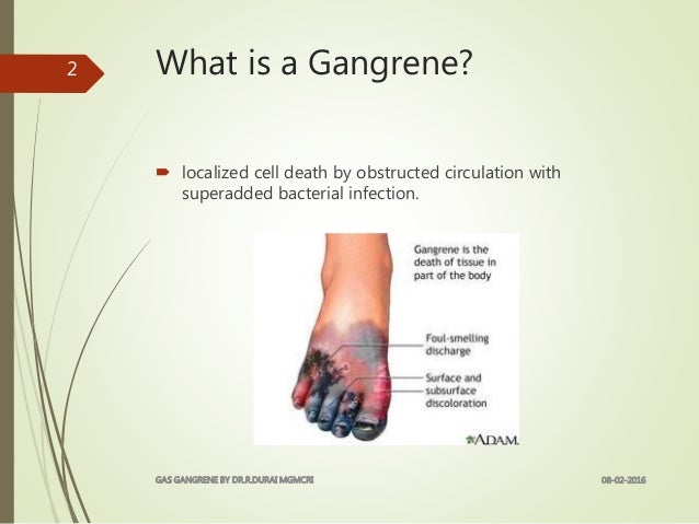 Gas gangrene 8 - 2- 16