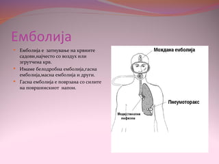 Gasna embolija | PPT