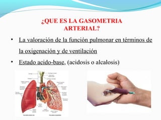 Gasometría arterial ppt | PPT