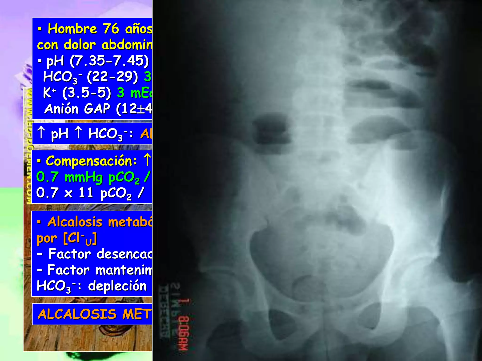 Gasometria arterial pulsioximetria_cooximetria | PPT