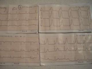 Gasometria arterial pulsioximetria_cooximetria | PPT