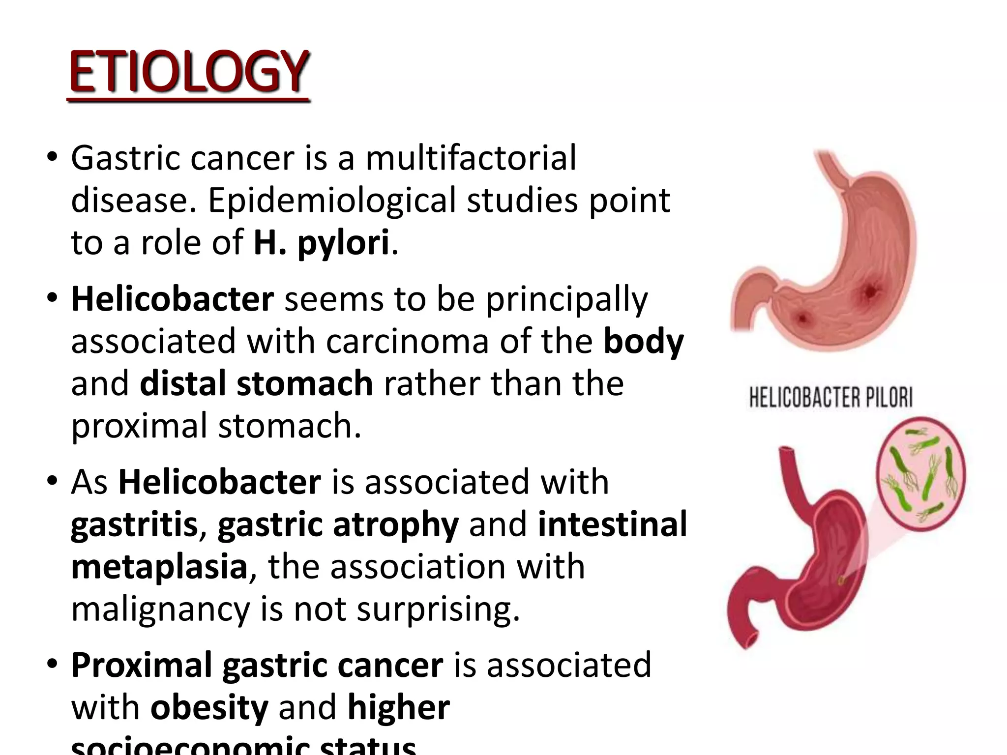 gastic carcinoma-1.pptx