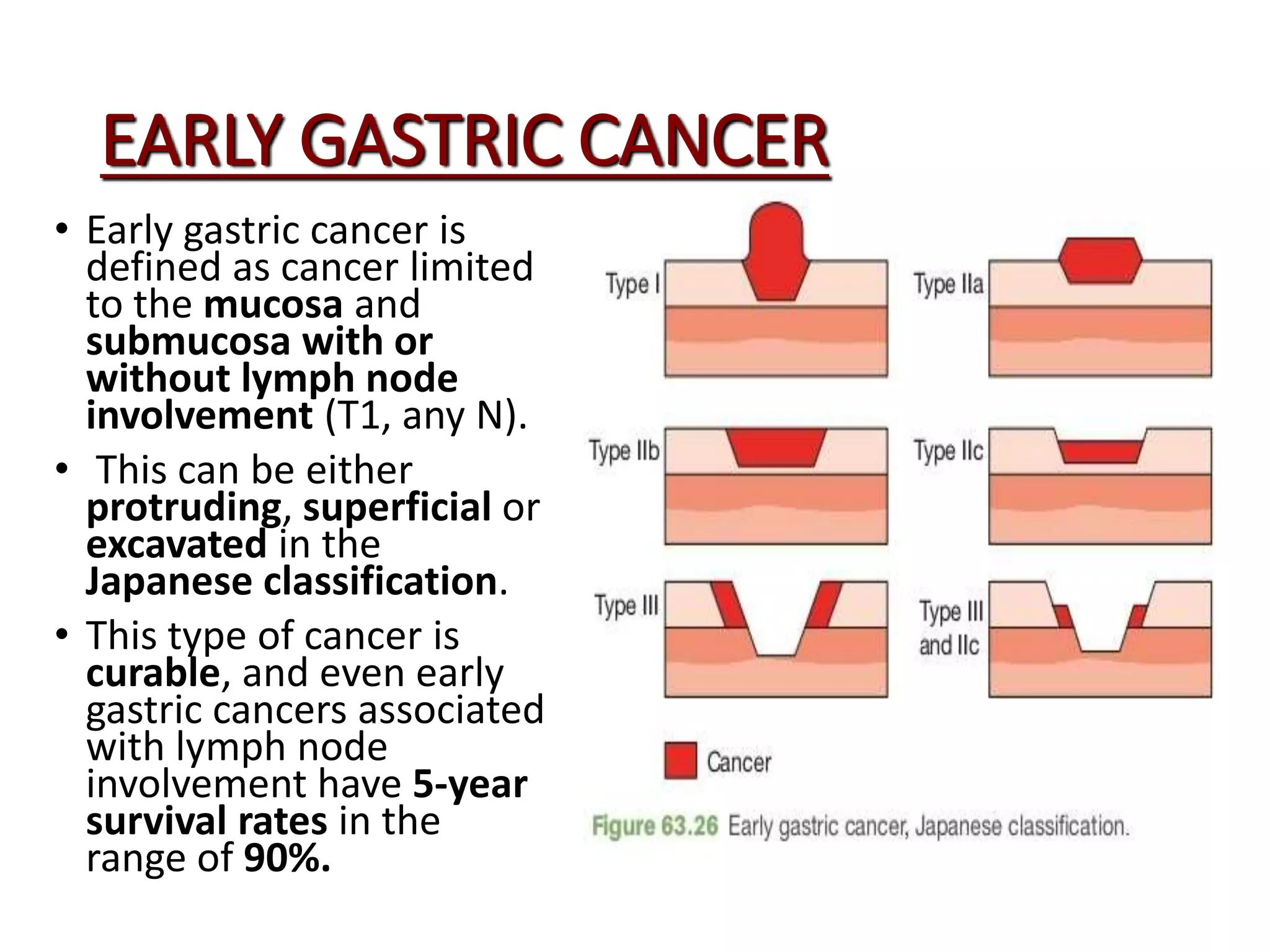 gastic carcinoma-1.pptx
