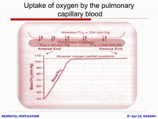 GAS TRANSPORT- NEONATAL VENTILATION HASSAN-2023.pptx