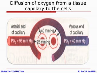 GAS TRANSPORT- NEONATAL VENTILATION HASSAN-2023.pptx