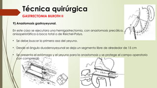 gastrectomia salcedo gastrectomia, tipos, clasificacion.pptx