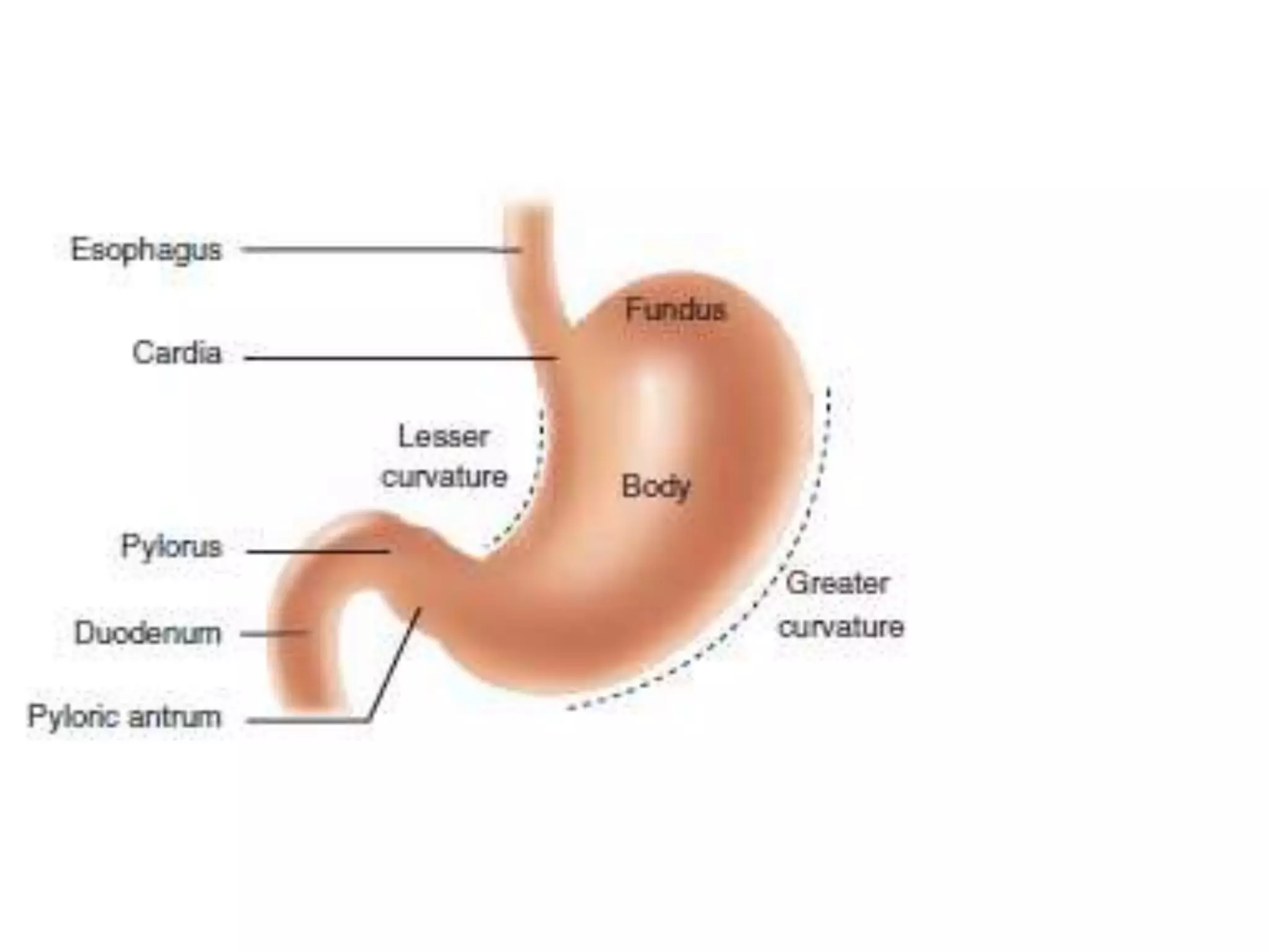 gastrectomy.pptx