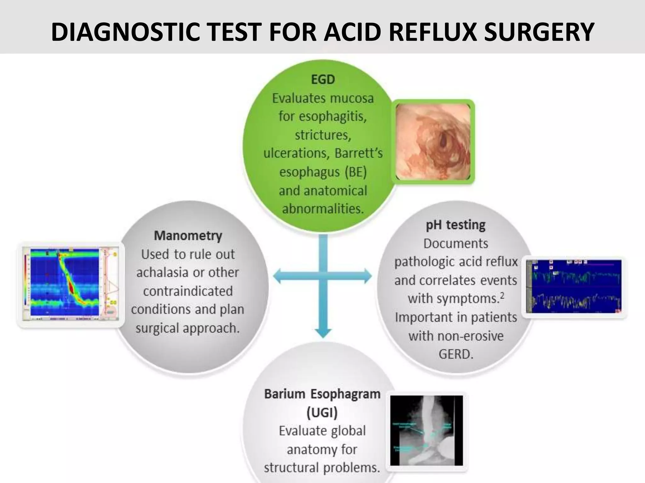 PHARMACOTHERAPY OF Gastric-oesophagal reflux disease [GERD] | PPTX