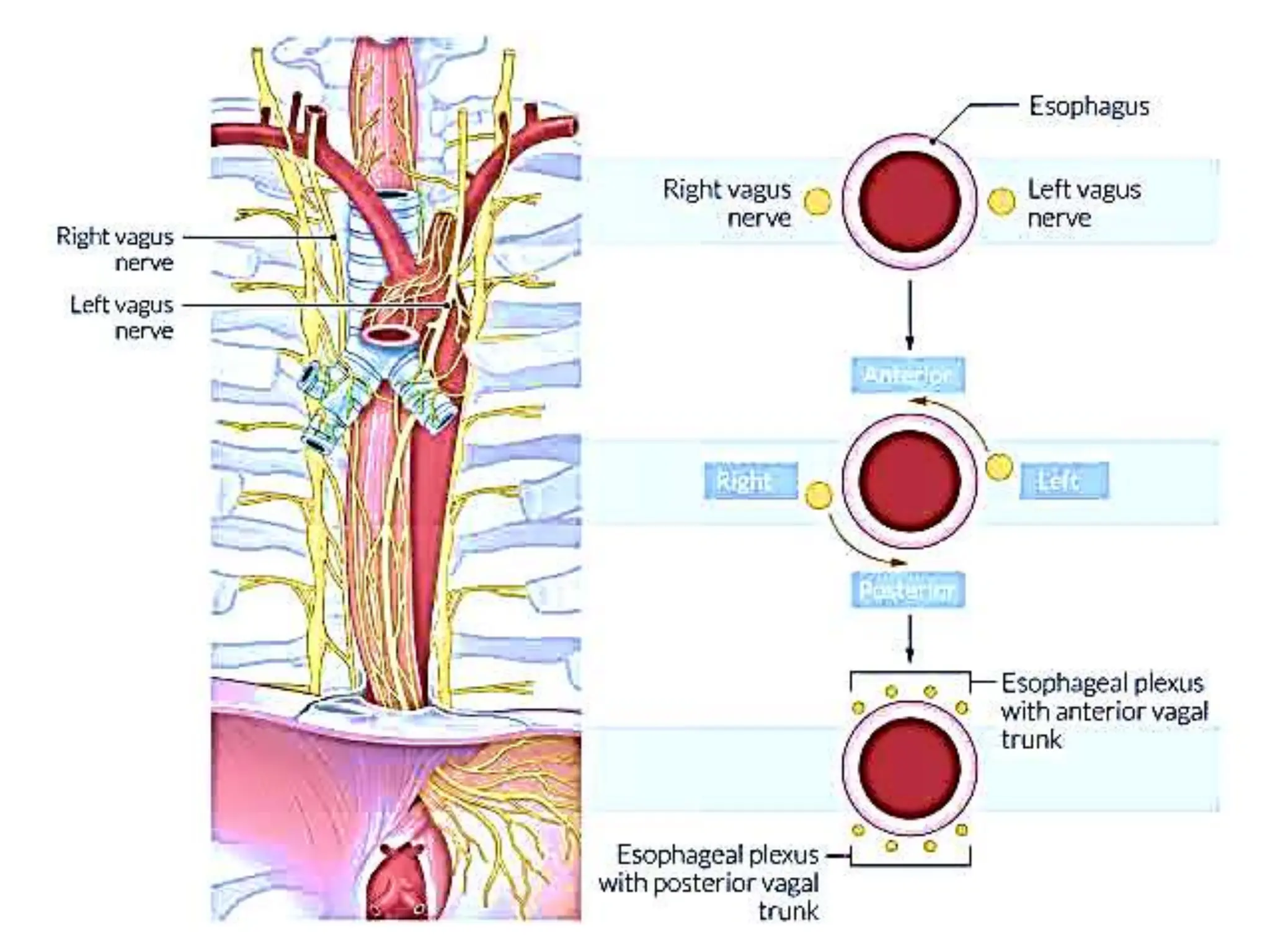 GASTRIC PERFORATION general surgery.pptx