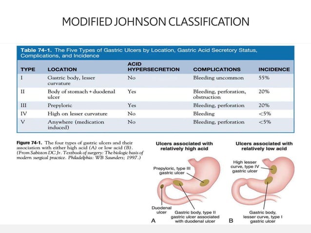 GASTRIC PERFORATION: A BRIEF SURGICAL MANAGEMNT | PPTX | Digestive ...