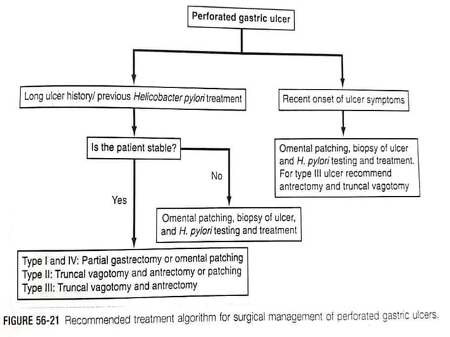 GASTRIC PERFORATION: A BRIEF SURGICAL MANAGEMNT | PPTX | Digestive ...