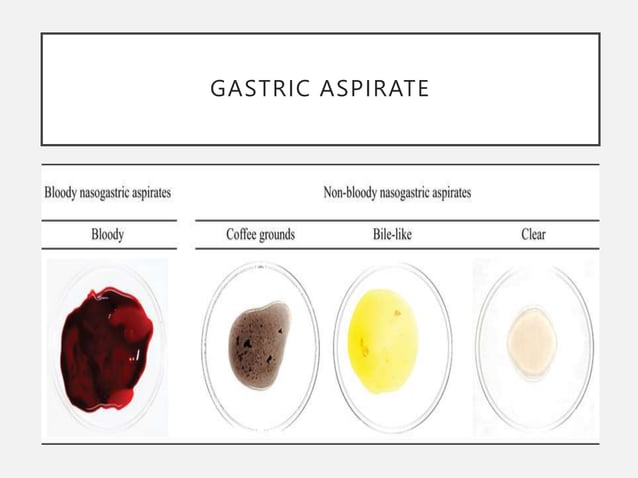 GASTRIC PERFORATION general surgery.pptx