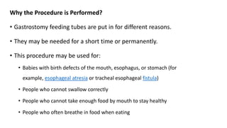 gastric_aspiration,_gastric_analysis_and_gastrostomy_feeding.pptx
